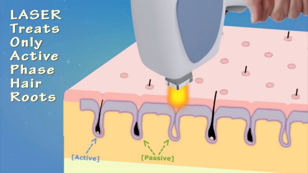 Hair Cycle / Skin Hair Cycle / Laser Hair Removal – Video