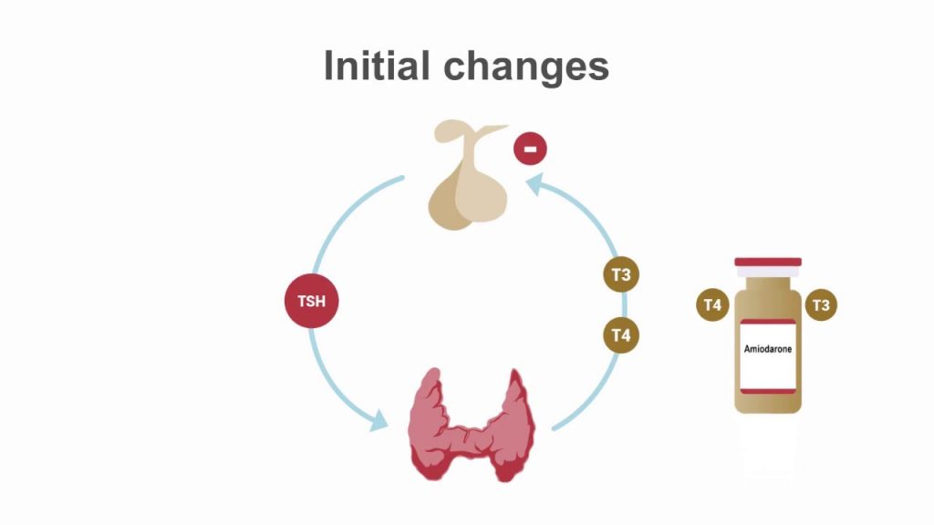 How amiodarone affects thyroid function. – Video