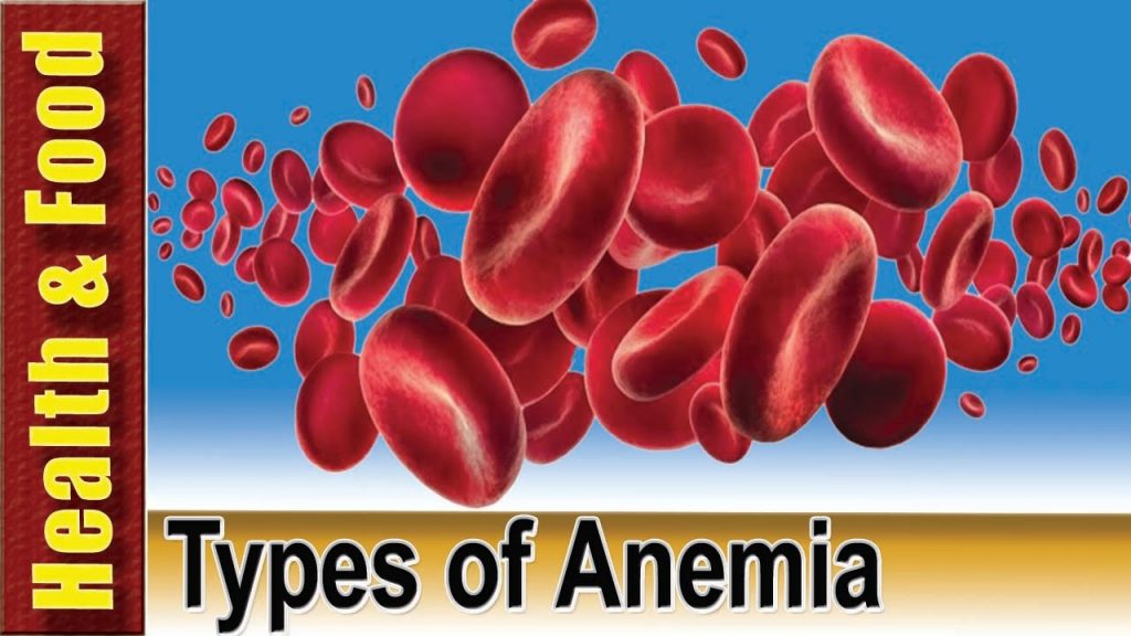 Types of Anemia | 5 Most Common Types of Anemia – Health & Food 2015 ...