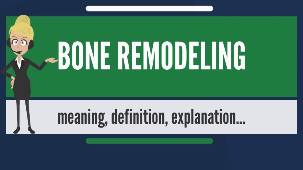 What is BONE REMODELING? What does BONE REMODELING mean? BONE ...