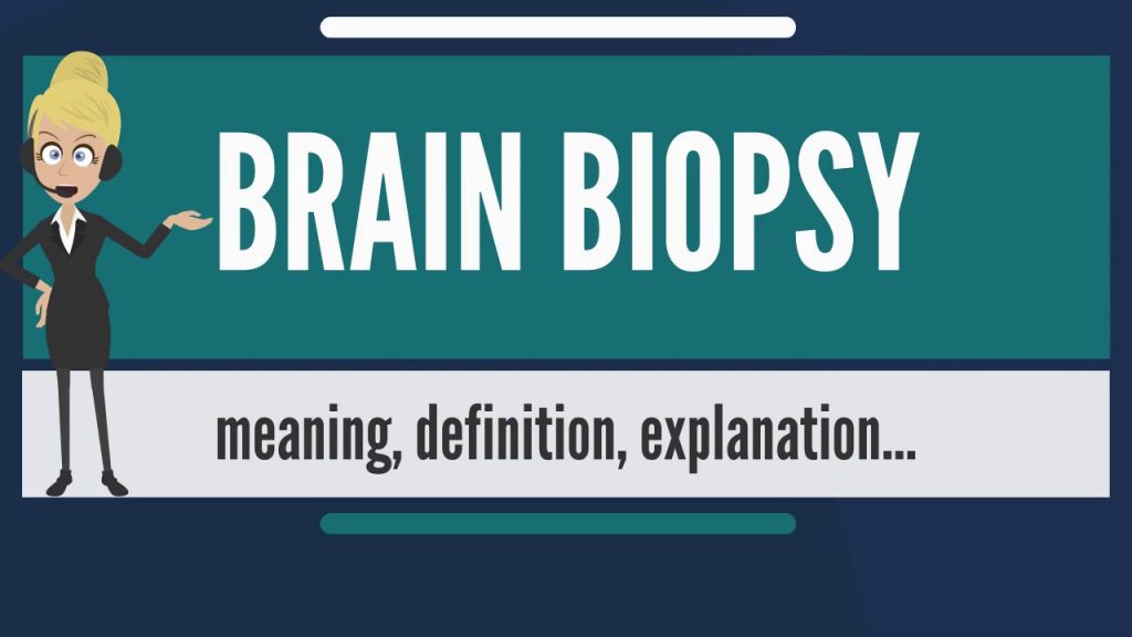 What is BRAIN BIOPSY? What does BRAIN BIOPSY mean? BRAIN BIOPSY meaning ...