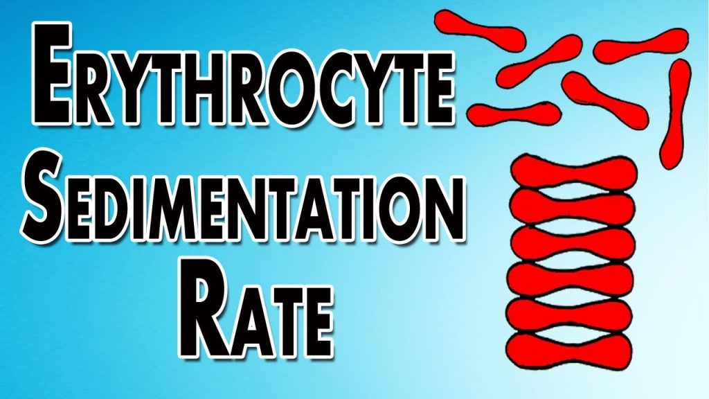 Erythrocyte Sedimentation Rate explained – Video