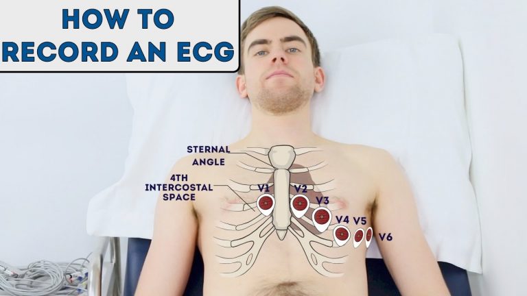 How to record an ECG – OSCE Guide – Video