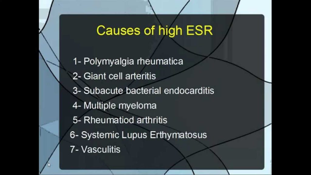 Notes on ESR Part 1 – Video