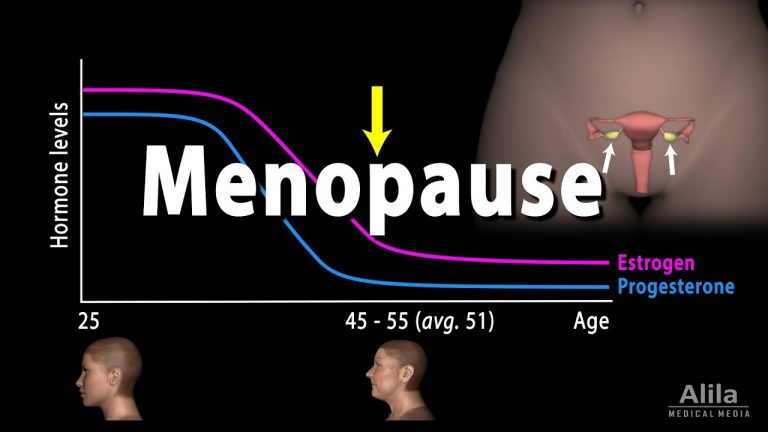 Menopause, Perimenopause, Symptoms and Management, Animation. – Video